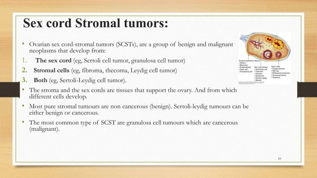 Ovarian Cancer Pptx