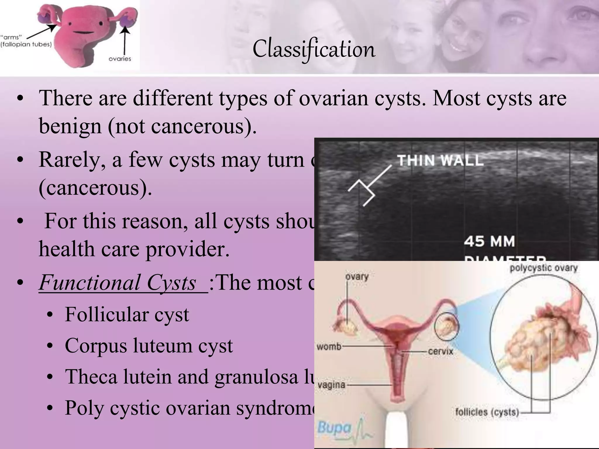 Ovarian cyst(gynec) | PPTX