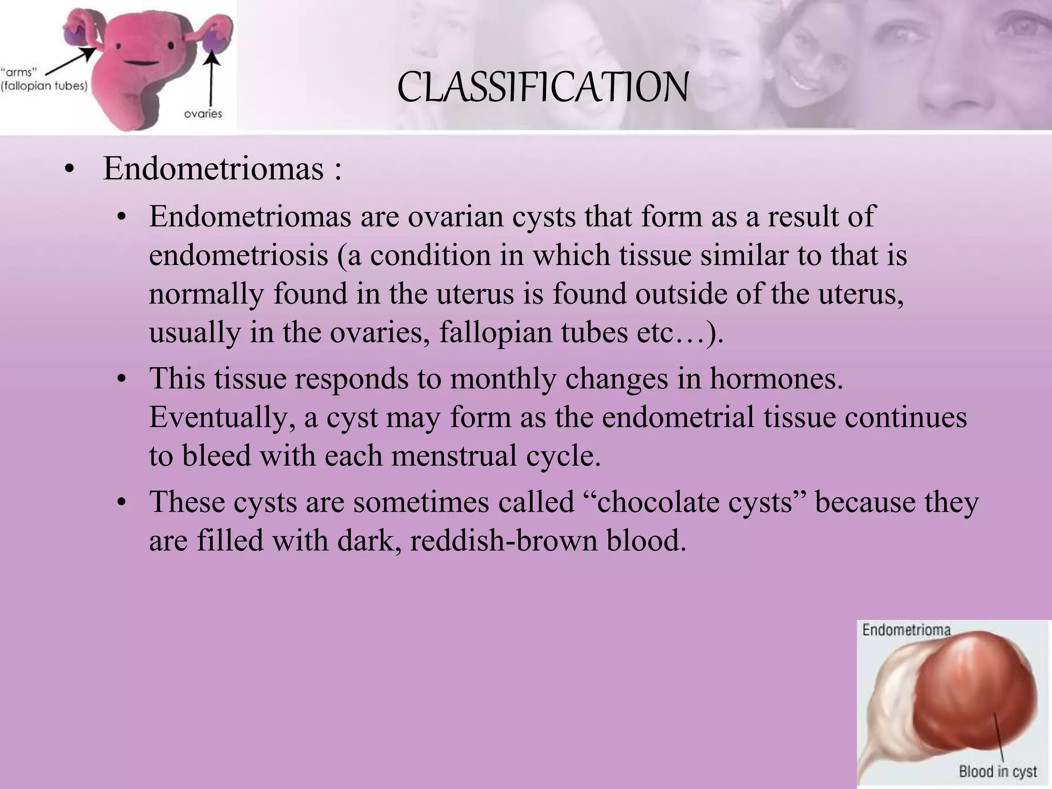 Ovarian cyst(gynec) | PPTX