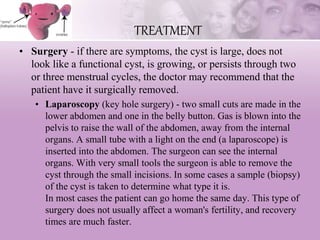 Ruptured Ovarian Cyst Bleeding