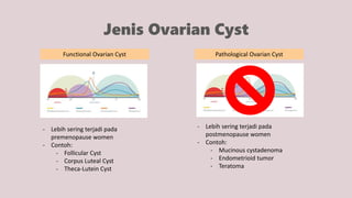 Ovarian Cyst | PPTX