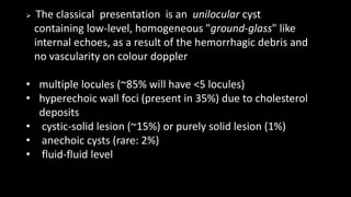 ovarian cyst.pptx