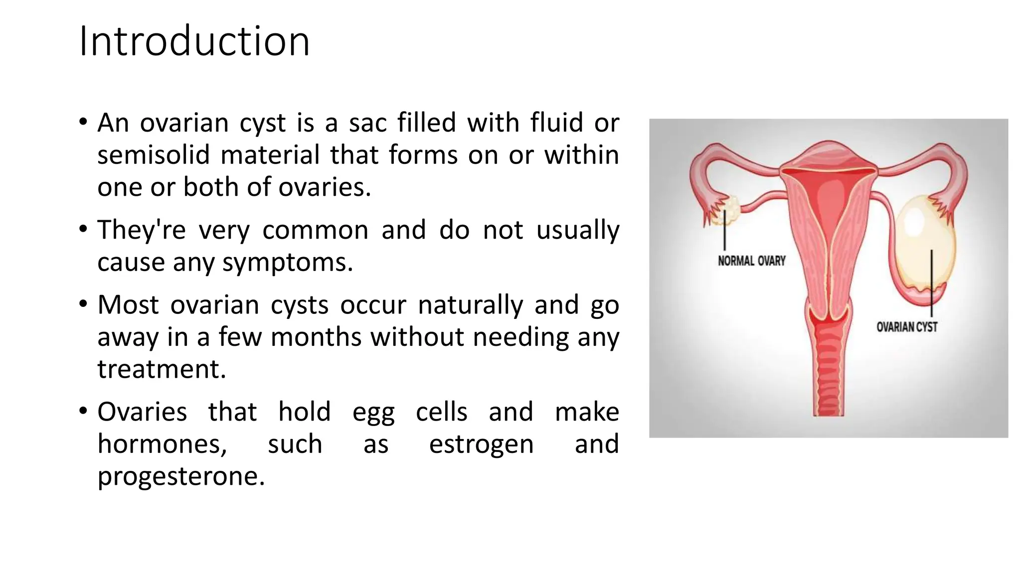 A lecture slide on Ovarian Cyst.pptx for nurses | PPTX