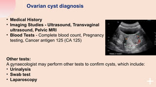 Disease of the Female Reproductive System- Ovarian Cyst.pptx