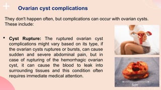 Ovarian Cyst.pptx