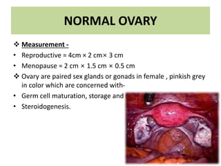Ovarian cyst and tumor | PPT
