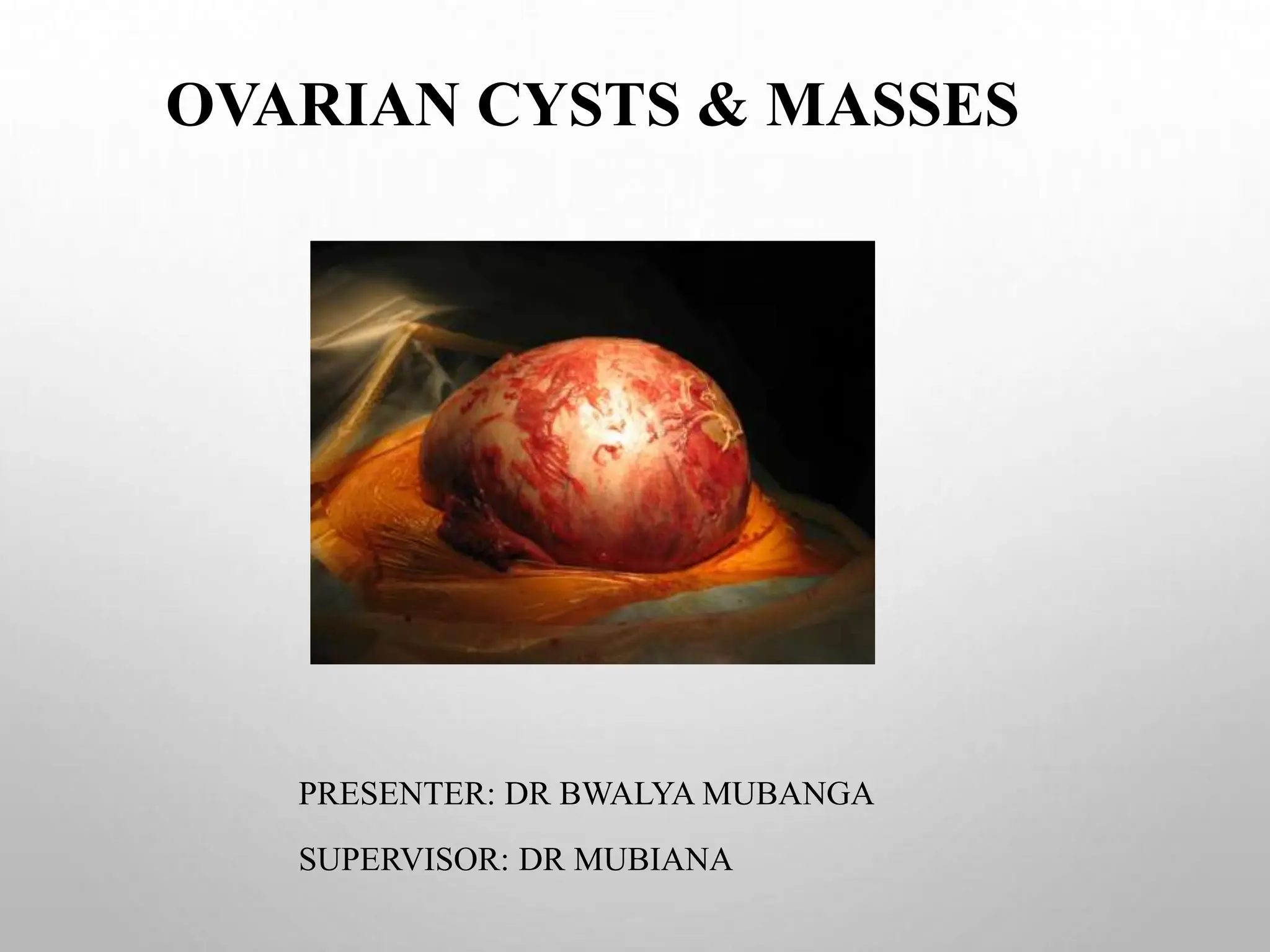 OVARIAN CYSTS & MASSES AND MANAGEMENT .pptx