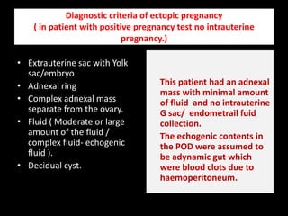 Ovarian ectopic pregnancy | PPTX