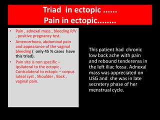 Ovarian ectopic pregnancy | PPTX | Pregnancy | Reproductive Health