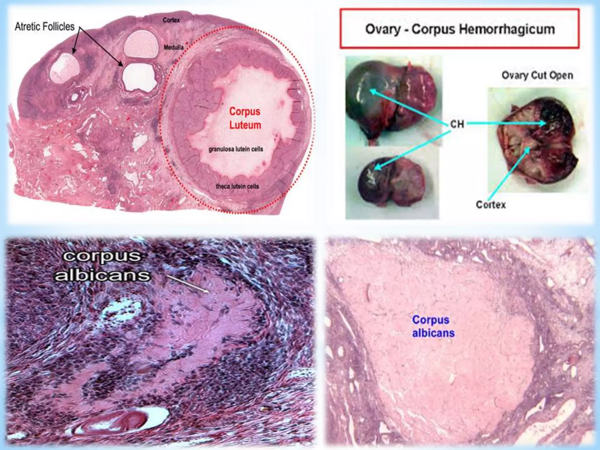Ovarian follicles; Histology - March 2015 | PPTX | Reproductive Health ...