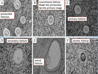 Ovarian follicles; Histology - March 2015 | PPTX | Reproductive Health ...
