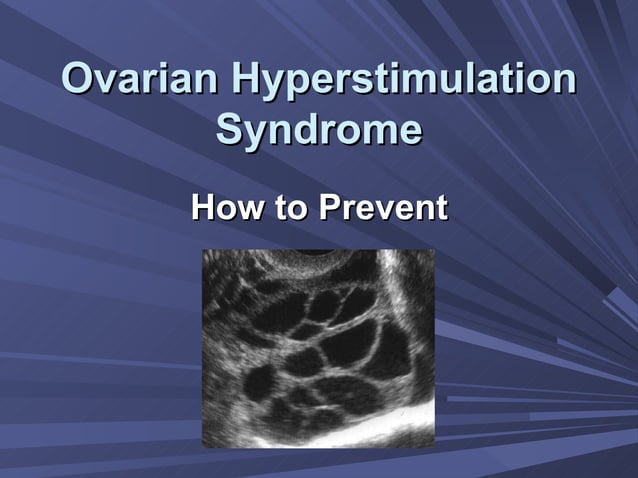 Ovarian hyperstimulation syndrome | PPT