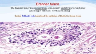 Ovarian Tumors | PPT