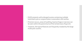 ovarian torsion.pptx