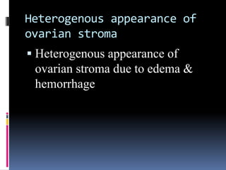 Ovarian Torsion.pptx