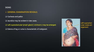 OVARIAN TUMOR - CF SPREAD SCREENING.pptx