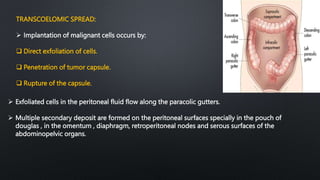 OVARIAN TUMOR - CF SPREAD SCREENING.pptx