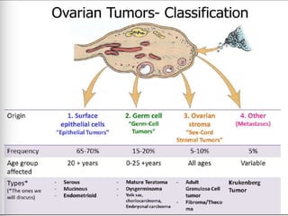 Ovarian tumors | PPT