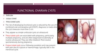 Ovarian Tumors 2.pptx gynecology lecture | PPT