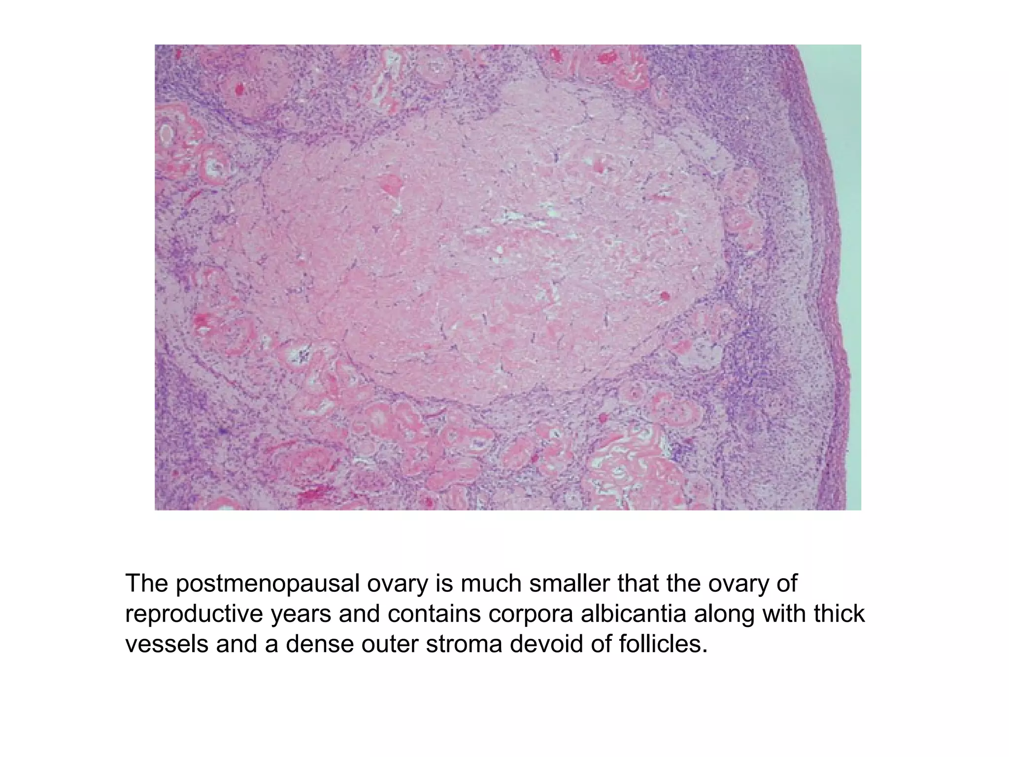 Ovaries | PPT | Infertility | Reproductive Health