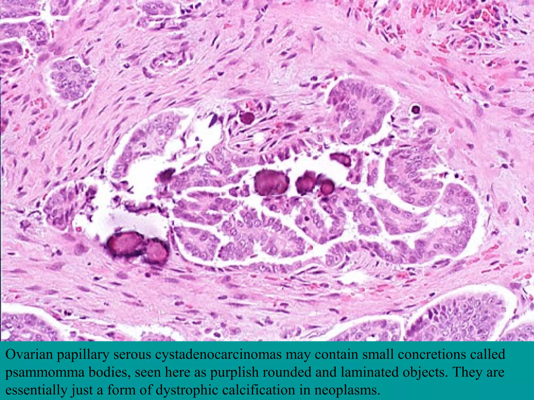 Ovaries | PPT | Infertility | Reproductive Health