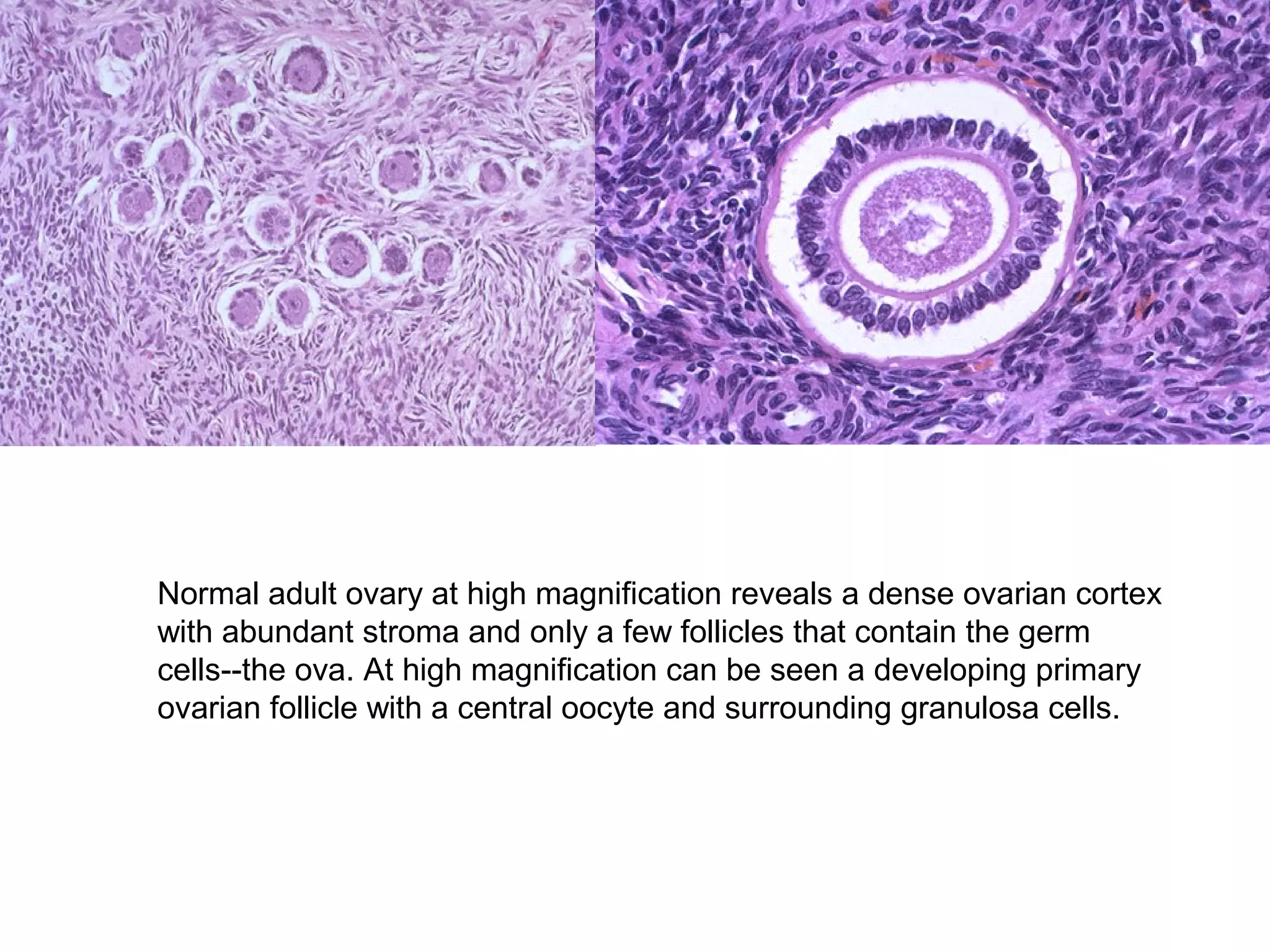 Ovaries | PPT