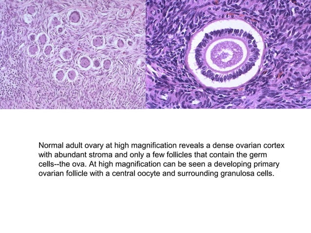 Ovaries | PPT | Infertility | Reproductive Health