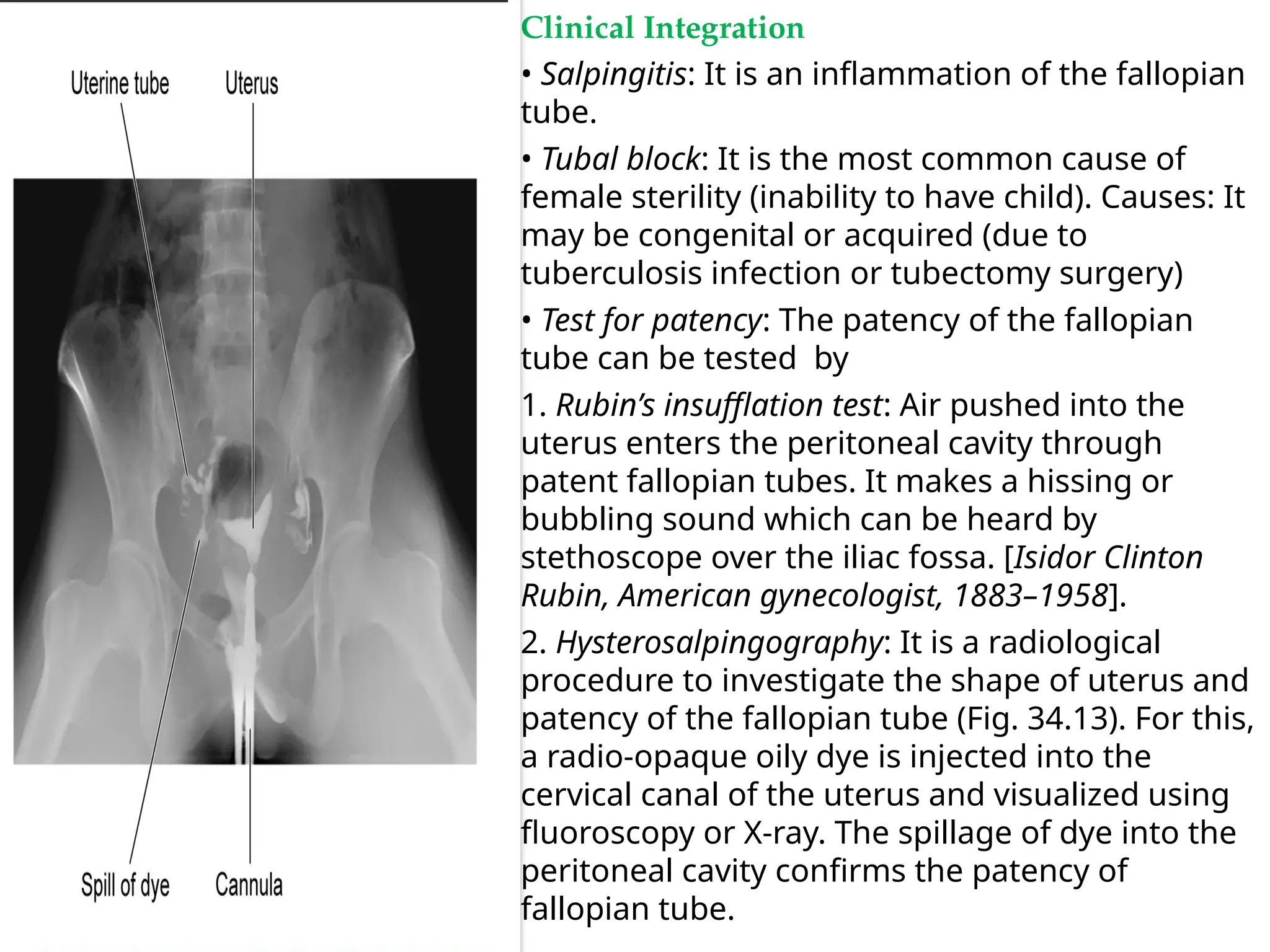 OVARIES and fallopian tube anatomy and ohysiology | PPTX