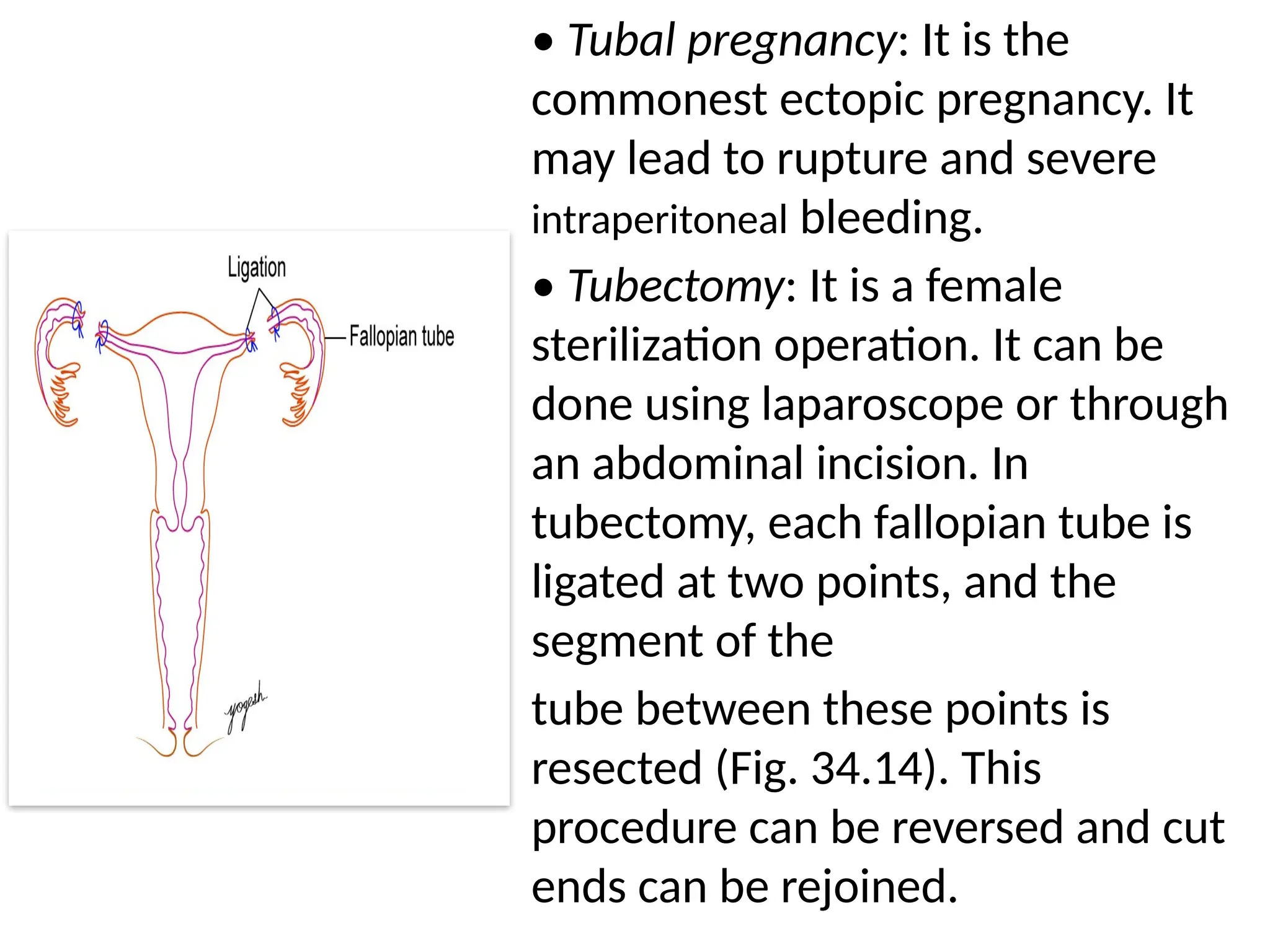 OVARIES and fallopian tube anatomy and ohysiology | PPTX