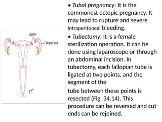 OVARIES and fallopian tube anatomy and ohysiology | PPTX