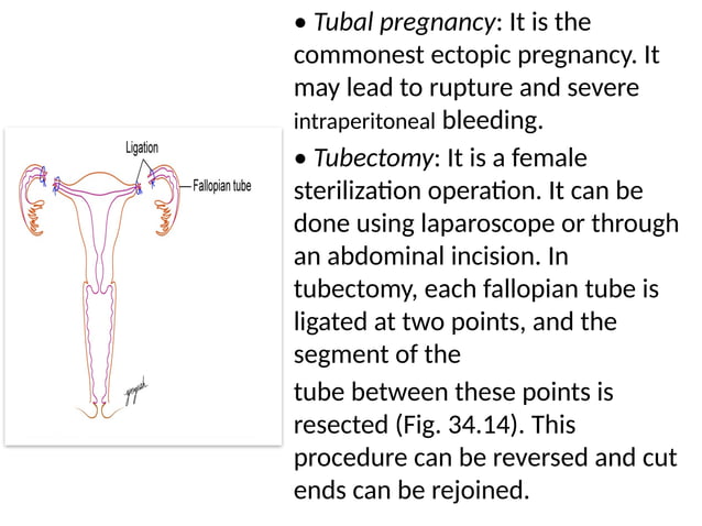 OVARIES and fallopian tube anatomy and ohysiology | PPTX