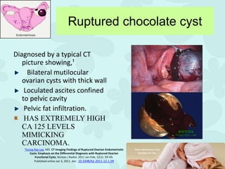 Ovary & emergency | PPT