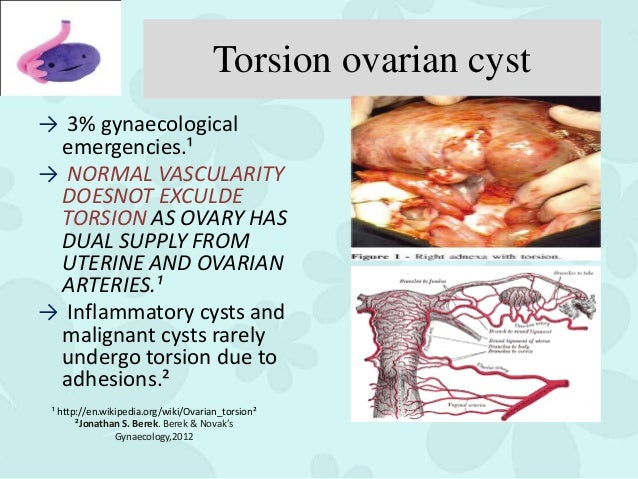 Ovary & emergency