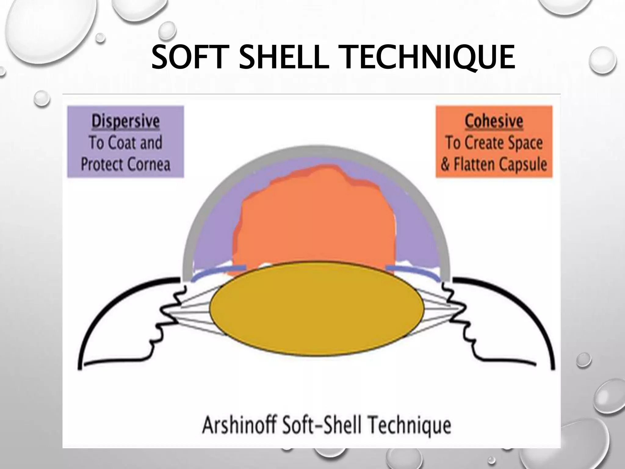 Ophthalmic Viscoelastic devices | PPTX