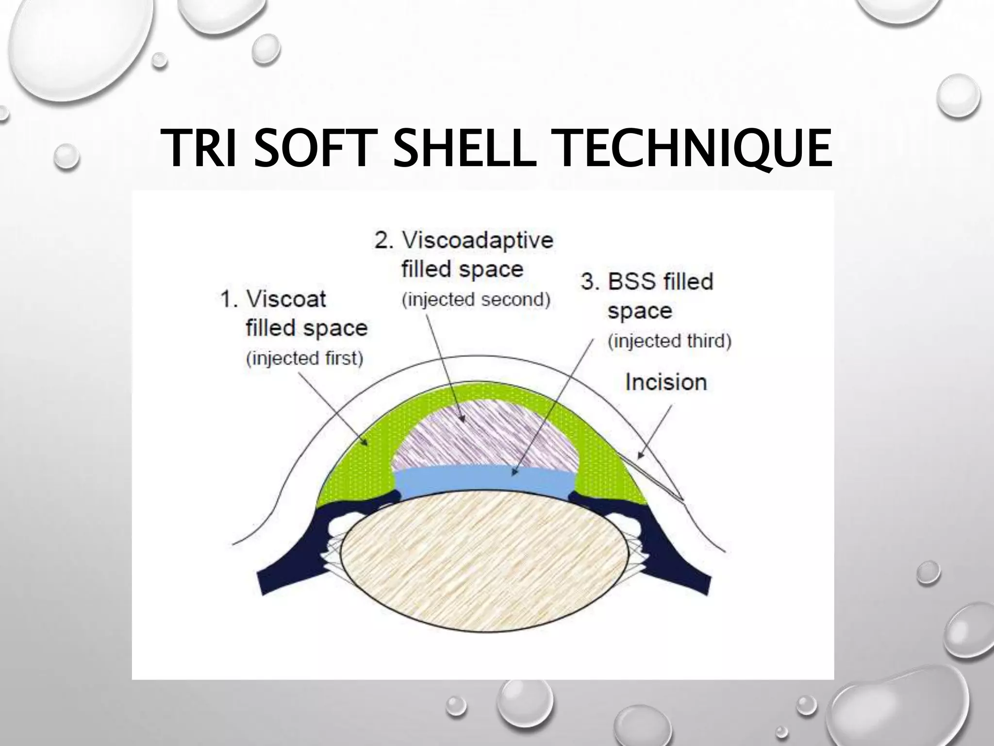 Ophthalmic Viscoelastic devices | PPTX