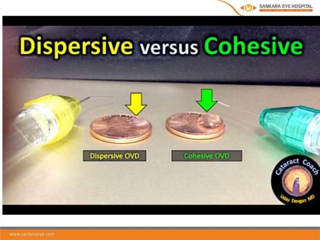 ophthalmic viscosurgical devices | PPTX | Eye and Vision Conditions ...