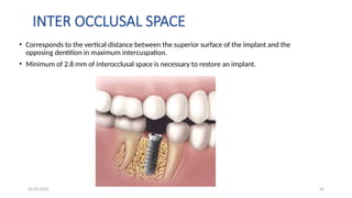 Implant supported overdenture, overdenture, implant occlusion, steps | PPTX