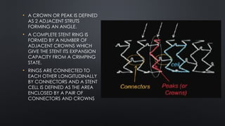 Over-expansion capacity and stent design model.pptx