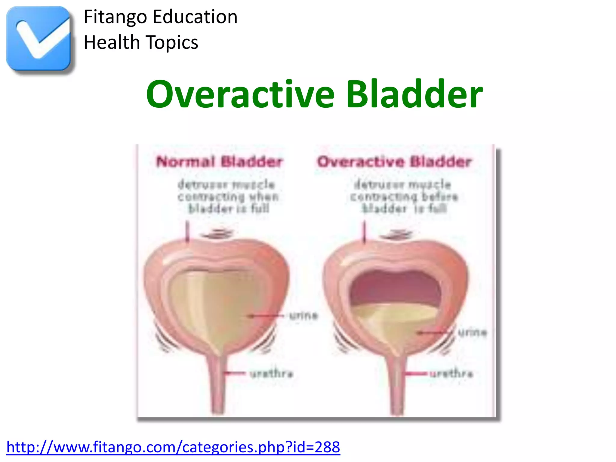 Overactive Bladder | PPT