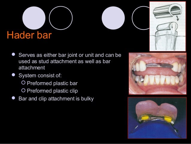 Overdenture /orthodontic courses by Indian dental academy
