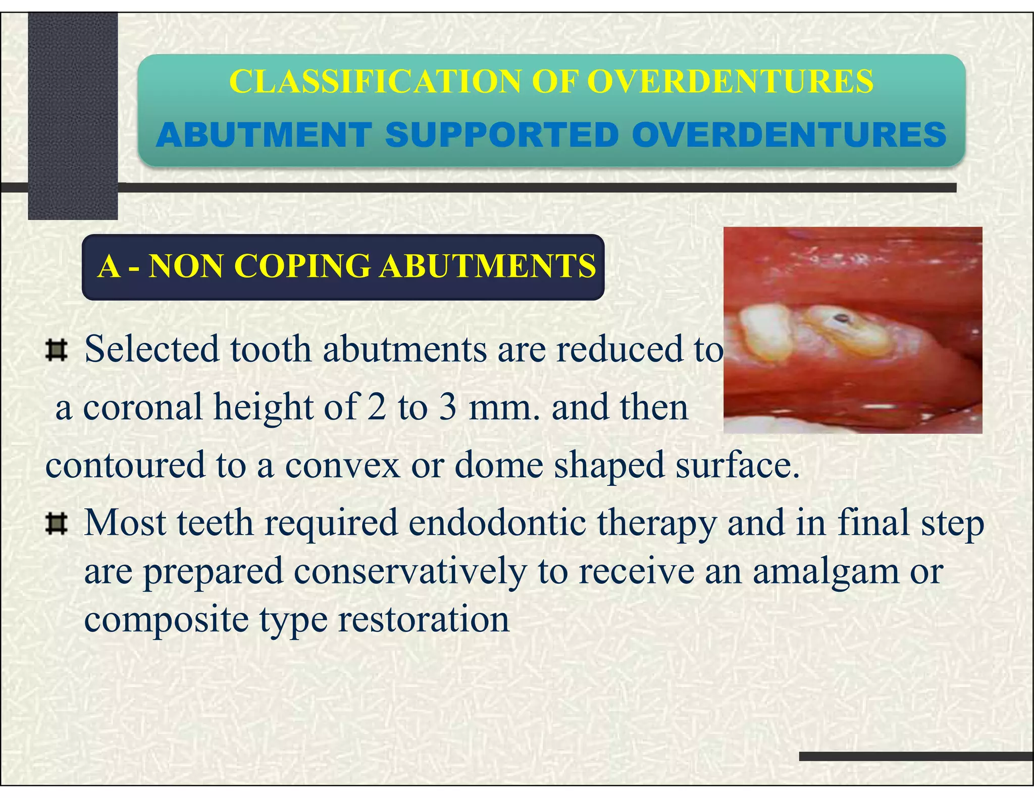 Over denture | PDF