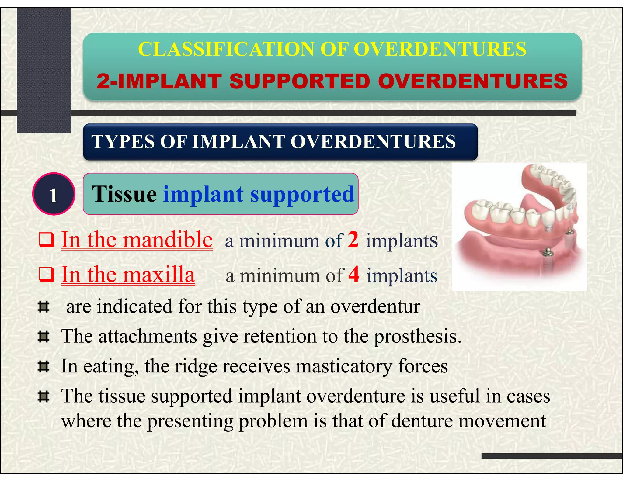 Over denture | PDF