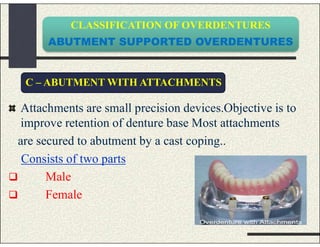 Over denture | PDF