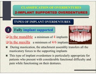 Over denture | PDF