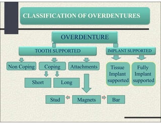 Over denture | PDF