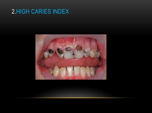 Over denture(s) | PPTX