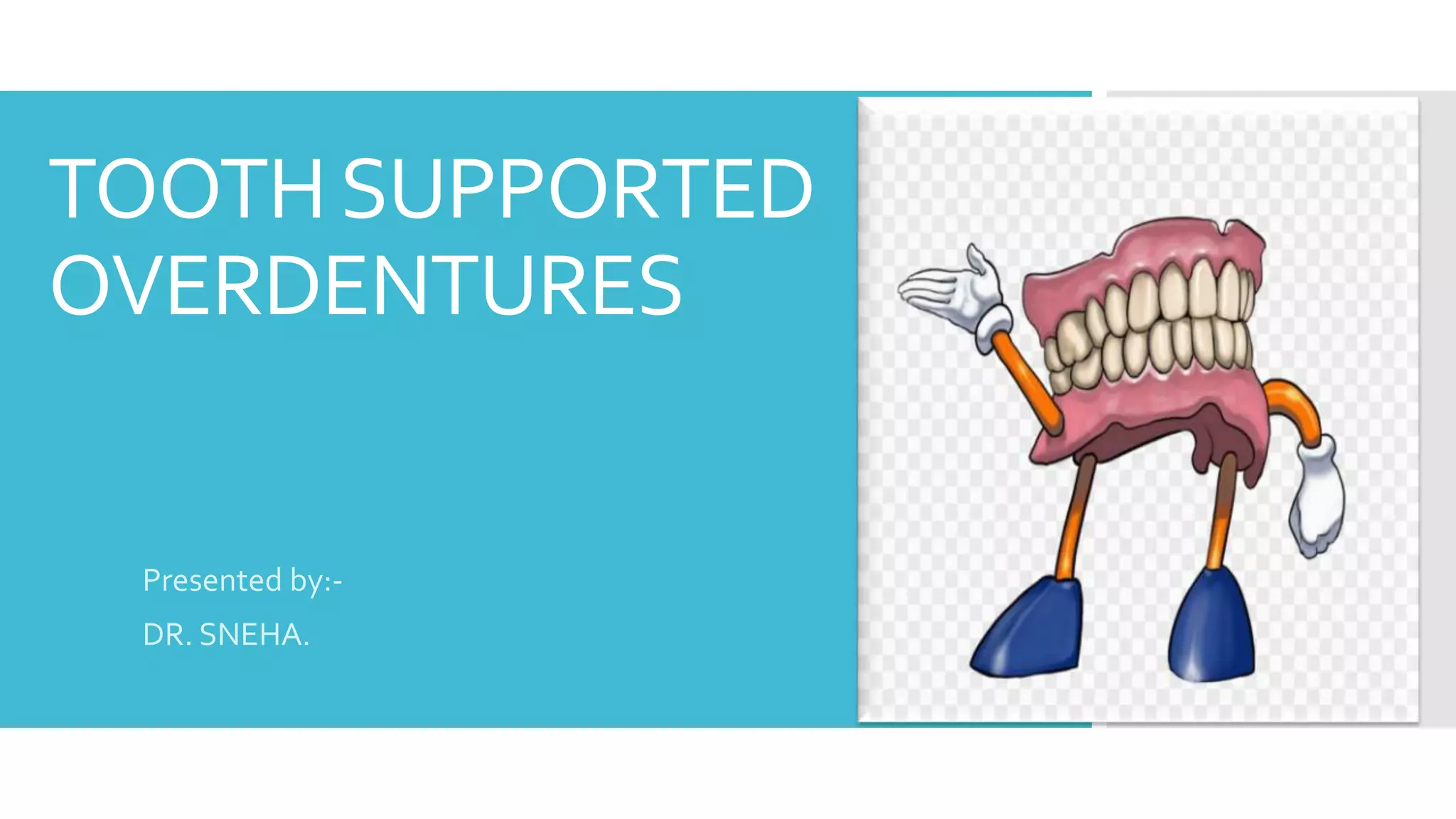 TOOTH SUPPORTED OVERDENTURES | PPTX