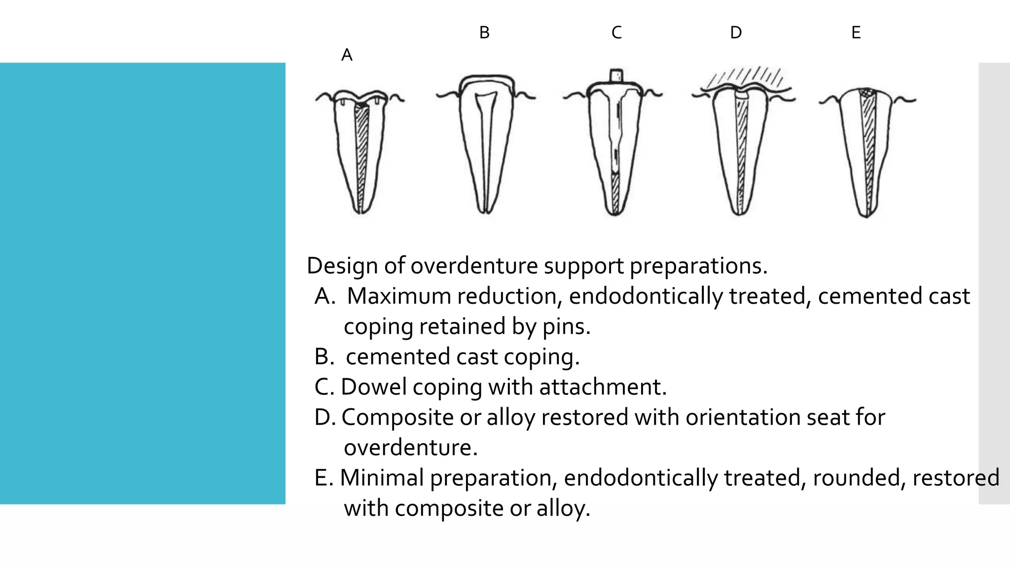 TOOTH SUPPORTED OVERDENTURES | PPTX