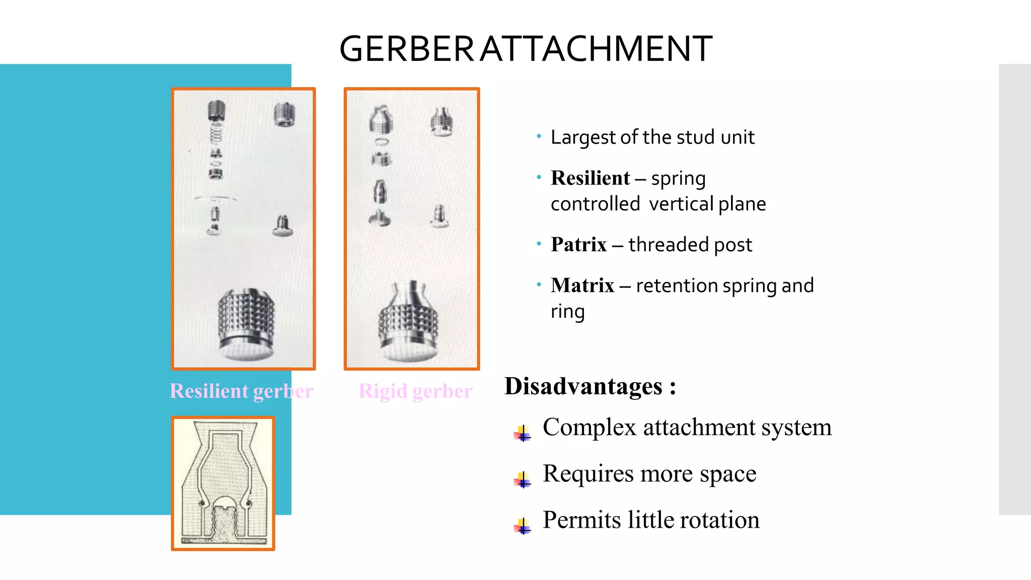 TOOTH SUPPORTED OVERDENTURES | PPTX