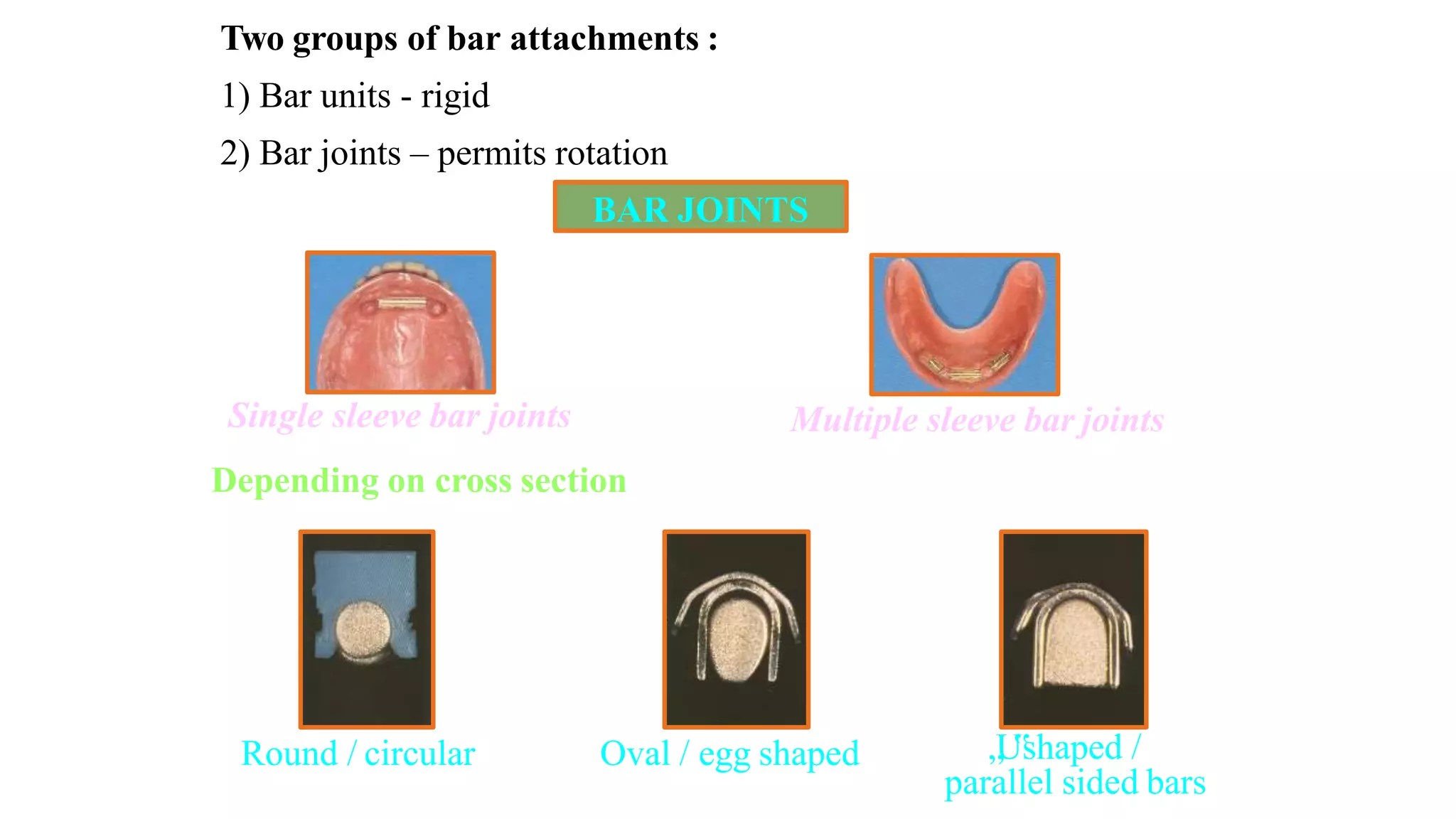 TOOTH SUPPORTED OVERDENTURES | PPTX